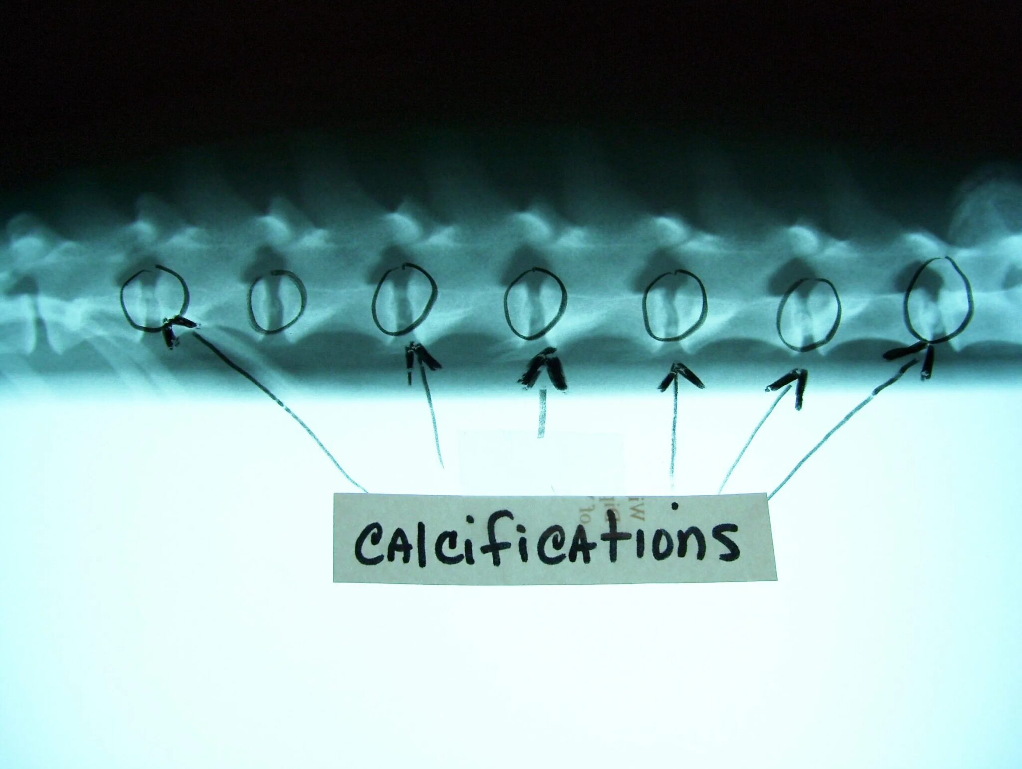 Prev Discharge Day List of Questions